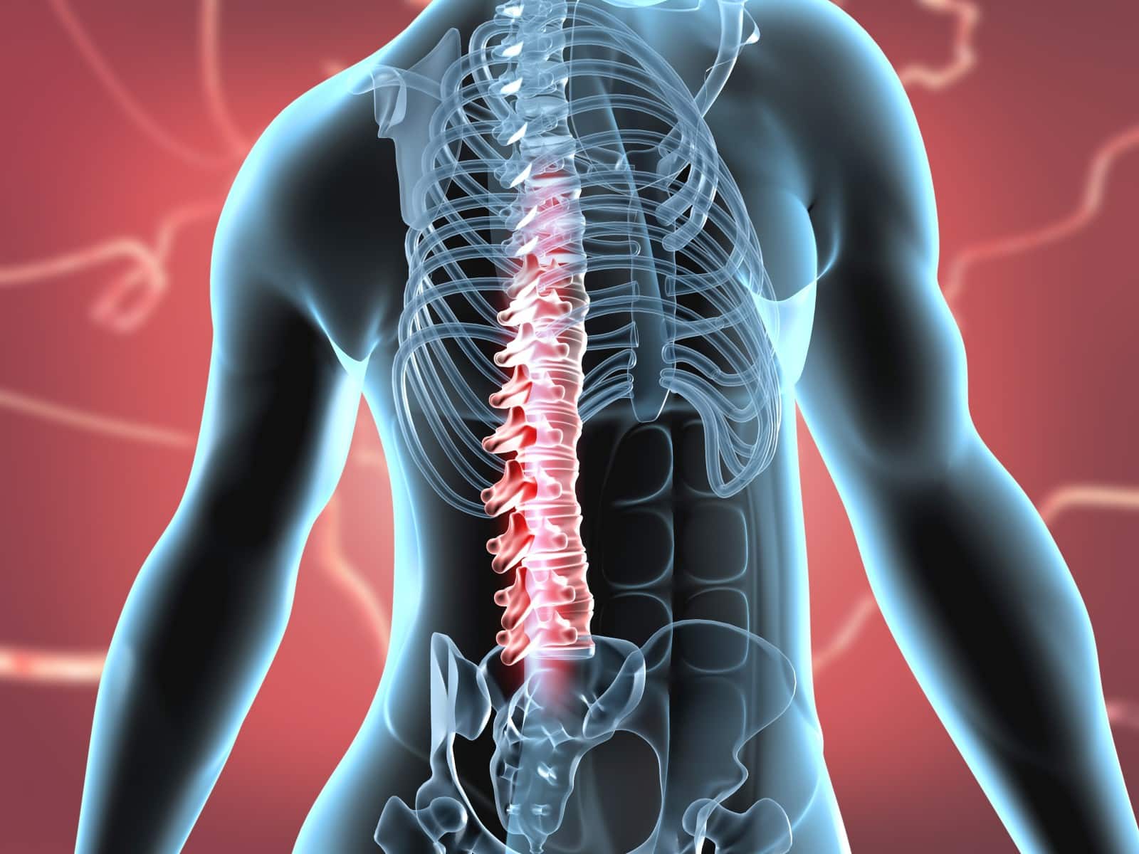 Spinal Cord Injuries and Pressure Ulcers: What You Need to Know ...